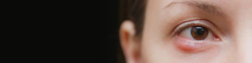 Chicago Abscess Drainage Urgent Care | South Loop, Oak Park, IL